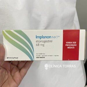 IMPLANON o chip contraceptivo: Valor #1 em SP